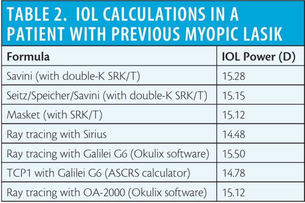 Ziemer Galilei G6 Corneal Topographer | Saturn Optical