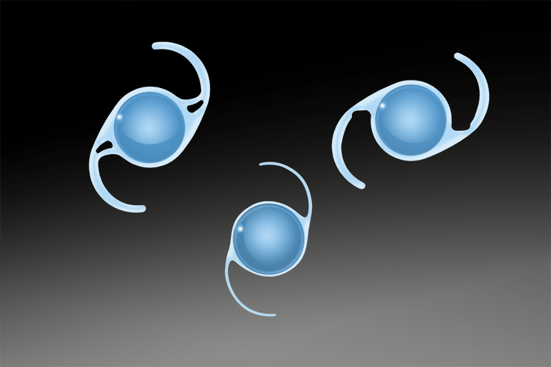 Lenstar LS900 Optical Biometer | Saturn Optical