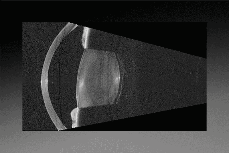 Haag-Streit Eyestar 900 Swept Source OCT - Saturn Optical