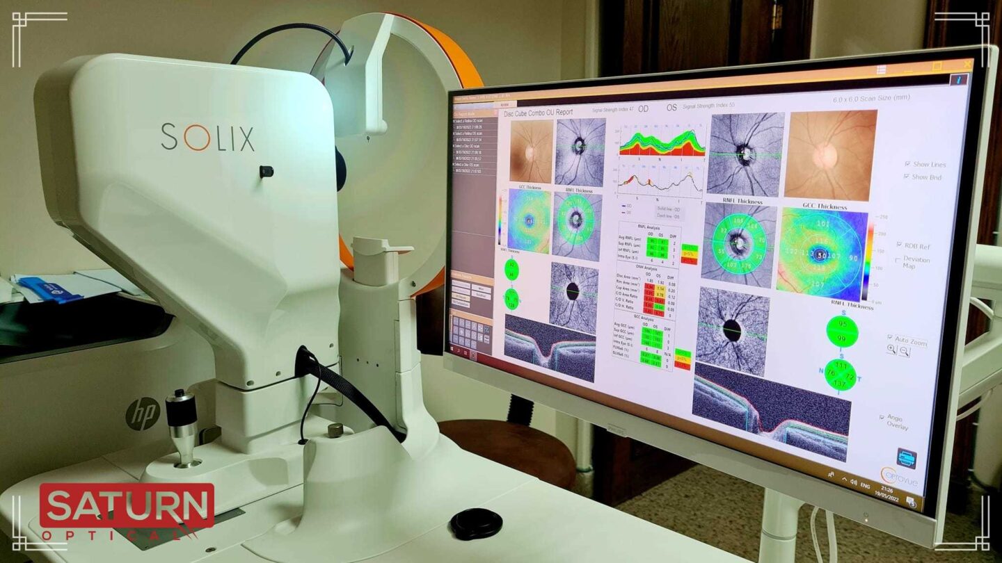 Optovue Solix OCT Angiography | Saturn Optical