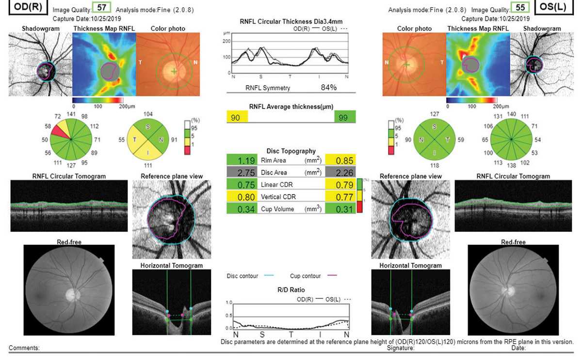 Topcon Maestro2 3D OCT: Advanced Retinal Imaging and Diagnostics