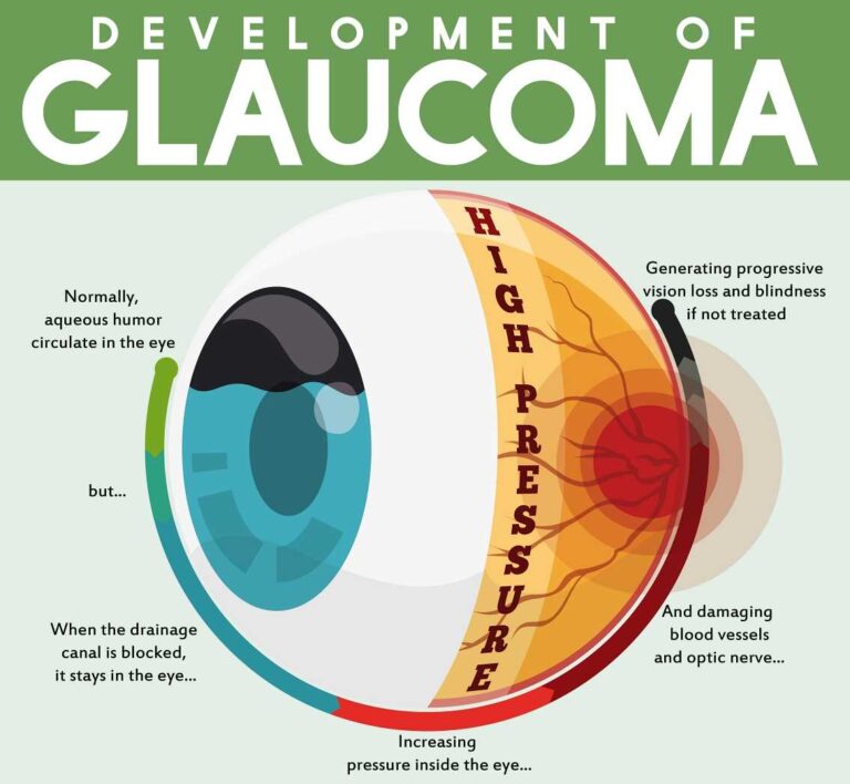 Understanding OCT Retinal Scan: A Comprehensive Guide - Saturn Optical