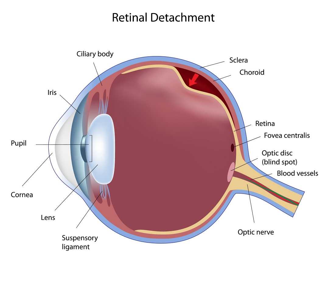 Understanding OCT Retinal Scan: A Comprehensive Guide