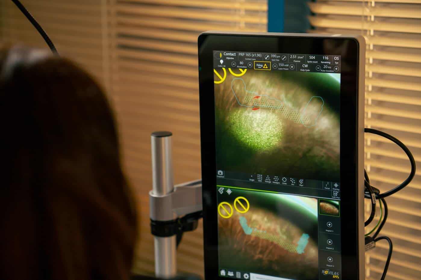 Advancements in Myopia and Dry Eye Treatment Technologies