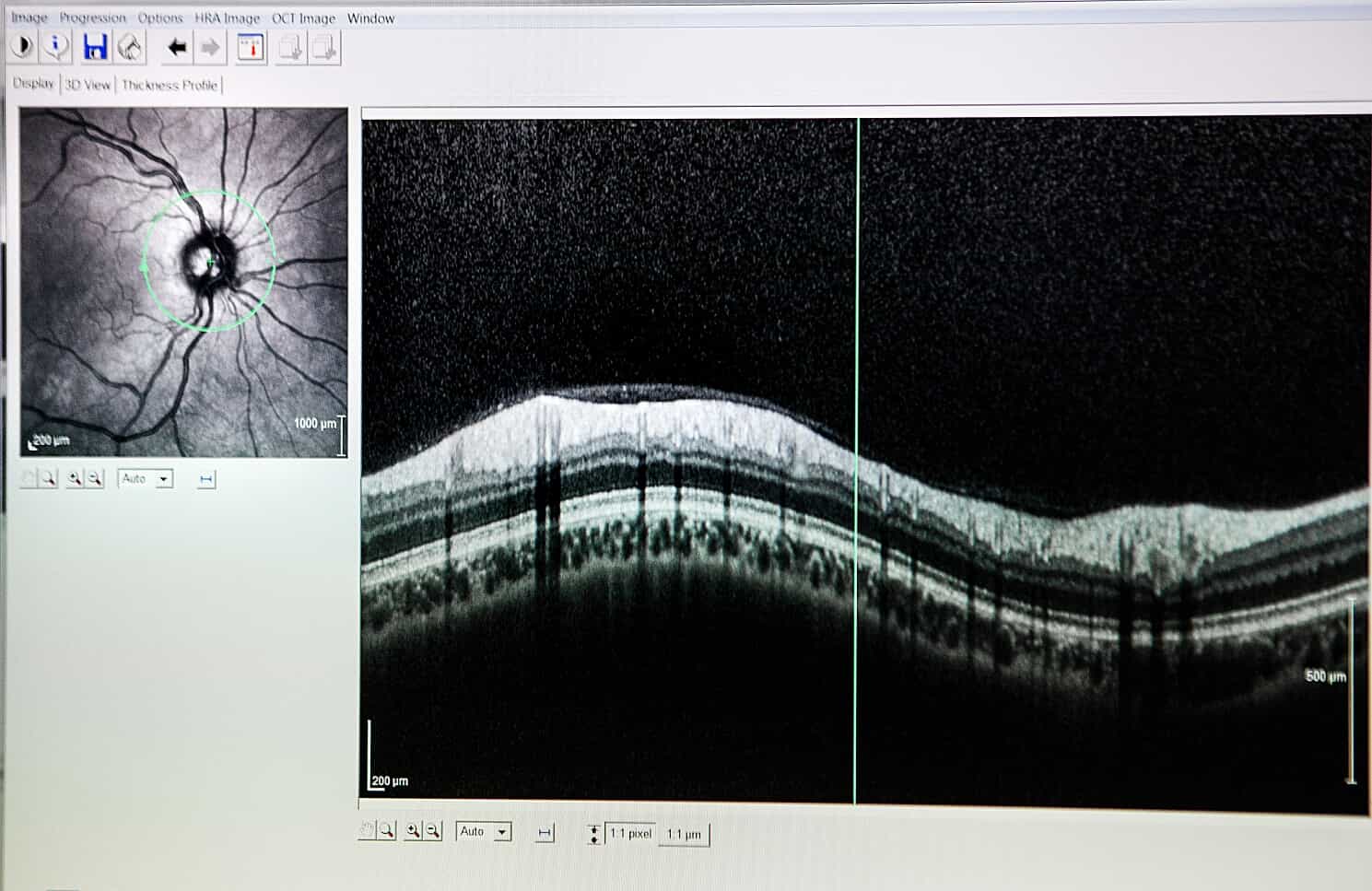 Top Reasons to Invest in Optical Coherence Tomography for Your Practice